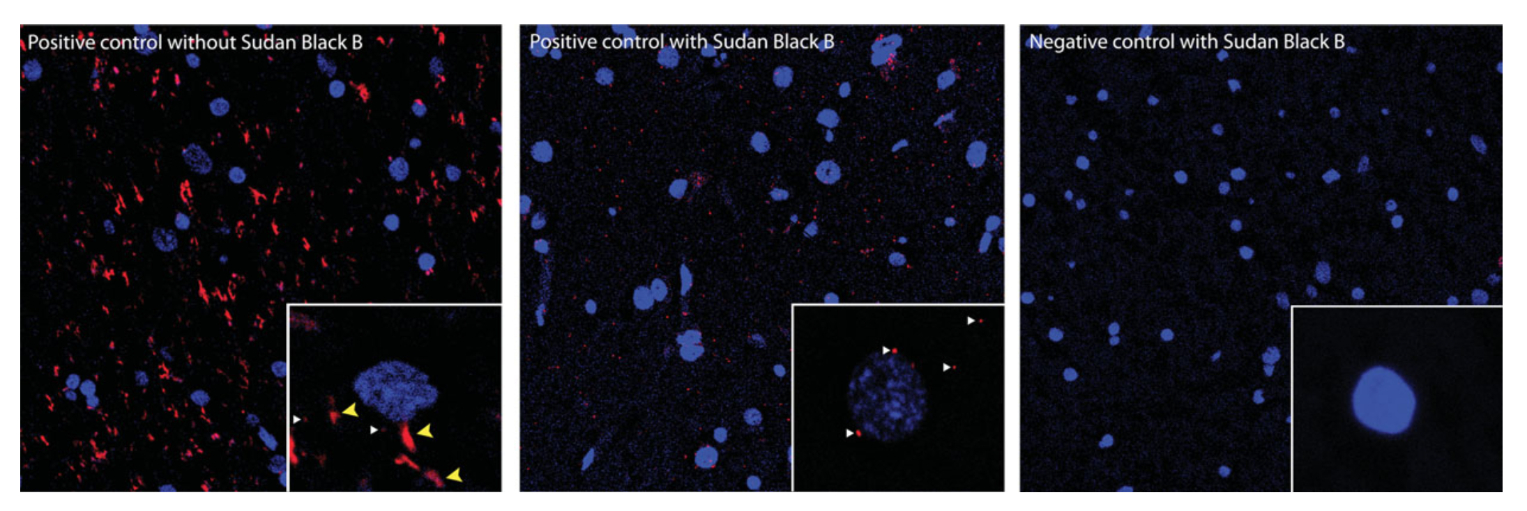 Bench Tips: Proximity Ligation Assay (PLA) Bench Tips: Proximity Ligation Assay (PLA)